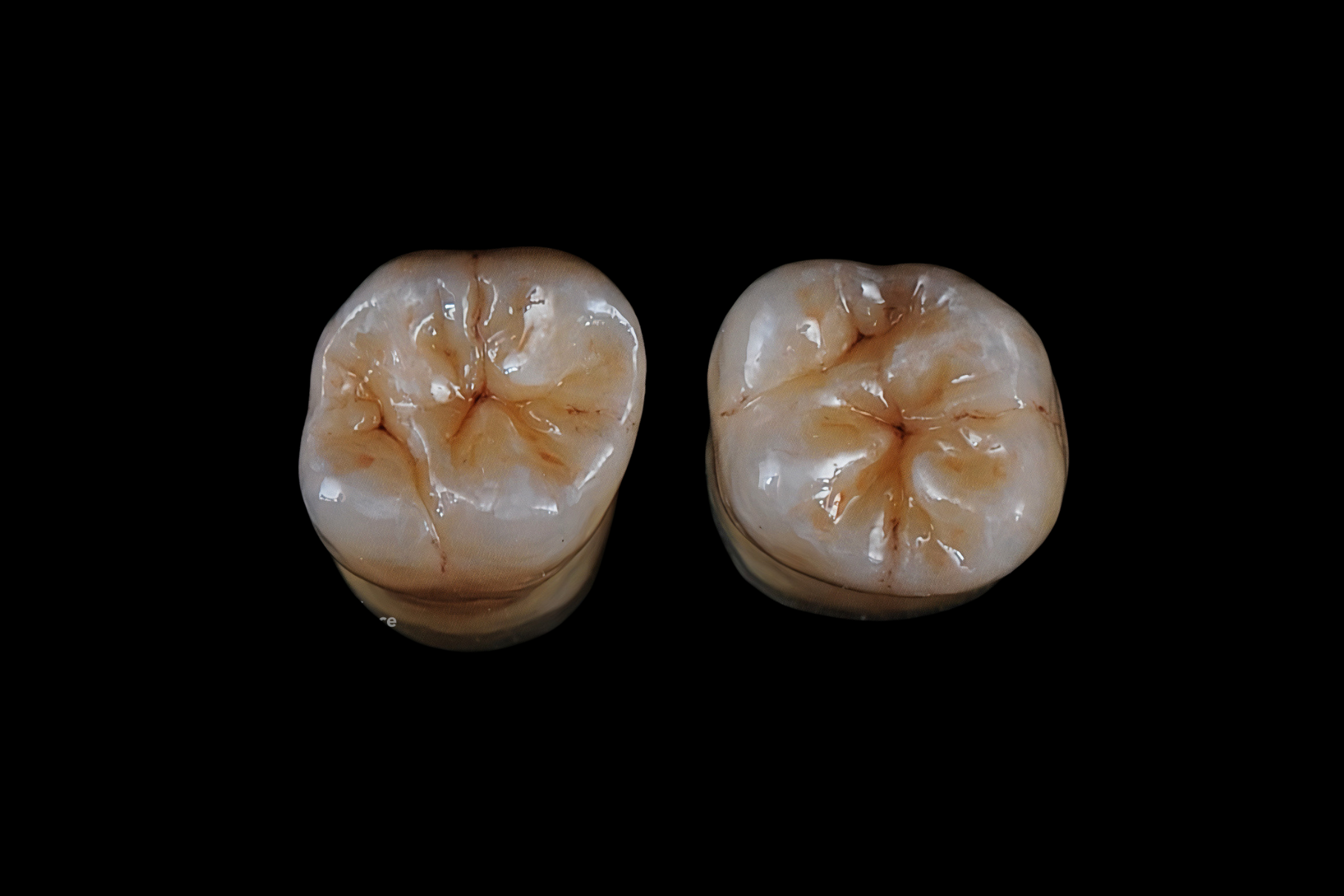Zirconia Solutions – Genesis Dental Lab