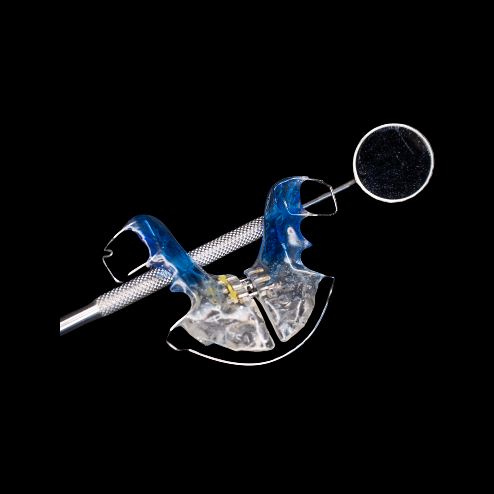 Expansion Appliances – Genesis Dental Lab